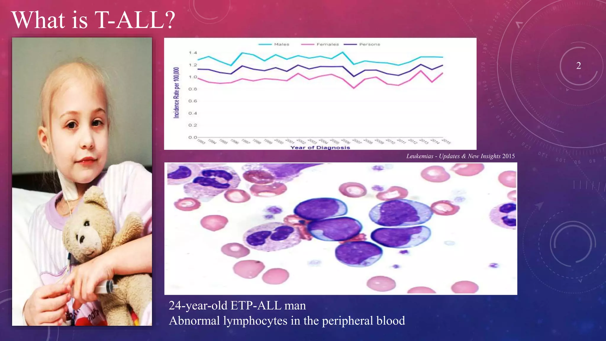 microRNA Message to T Cell Acute Lymphoblastic Leukemia | PPTX