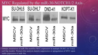 microRNA Message to T Cell Acute Lymphoblastic Leukemia | PPTX