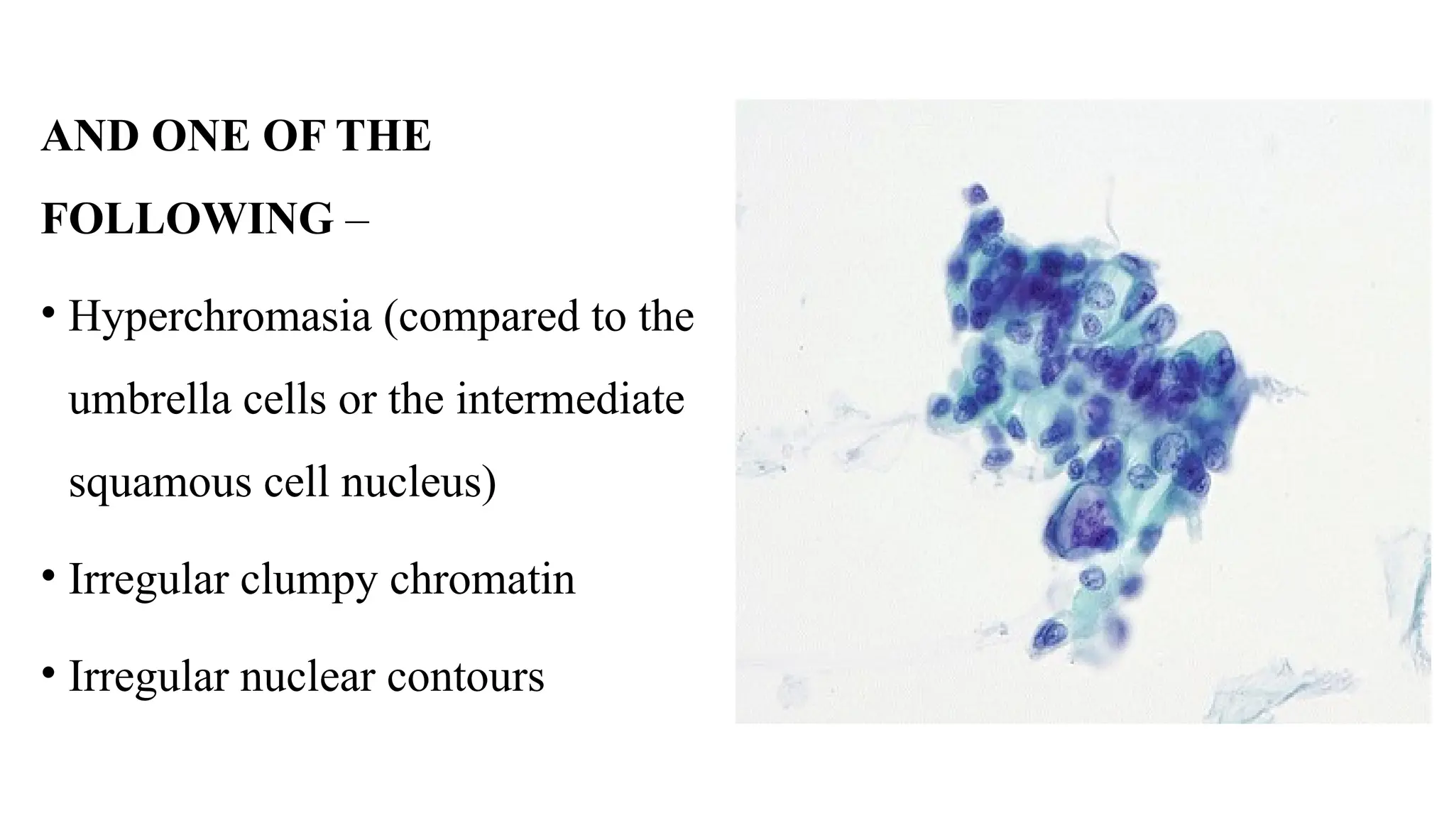 PARIS SYSTEM FOR URINE CYTOLOGY paris system of reporting urine ...