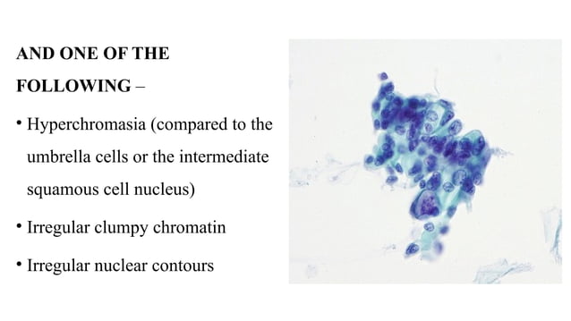 PARIS SYSTEM FOR URINE CYTOLOGY paris system of reporting urine ...