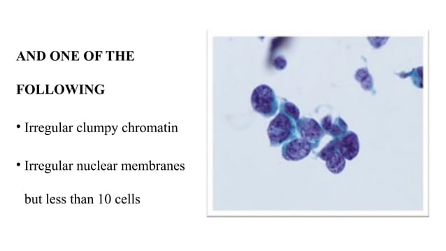 PARIS SYSTEM FOR URINE CYTOLOGY paris system of reporting urine ...
