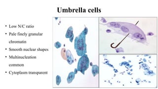 PARIS SYSTEM FOR URINE CYTOLOGY paris system of reporting urine ...