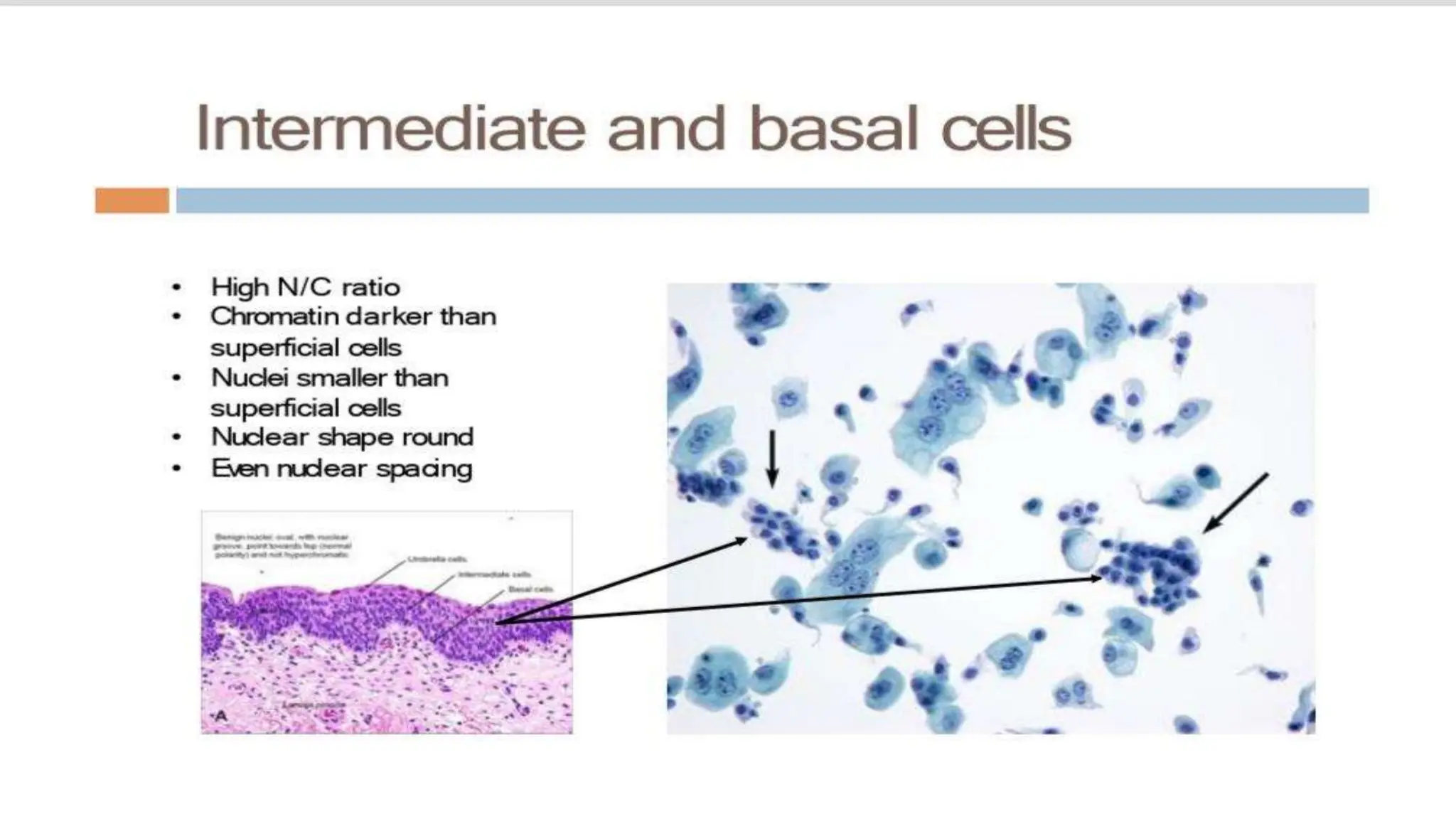 paris system of urine (cytology)Dr.Ankita Singh | PPTX