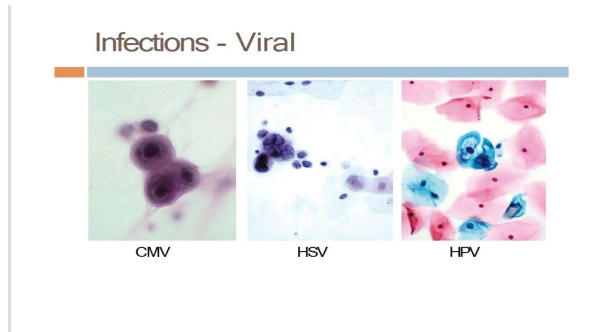 paris system of urine (cytology)Dr.Ankita Singh | PPTX