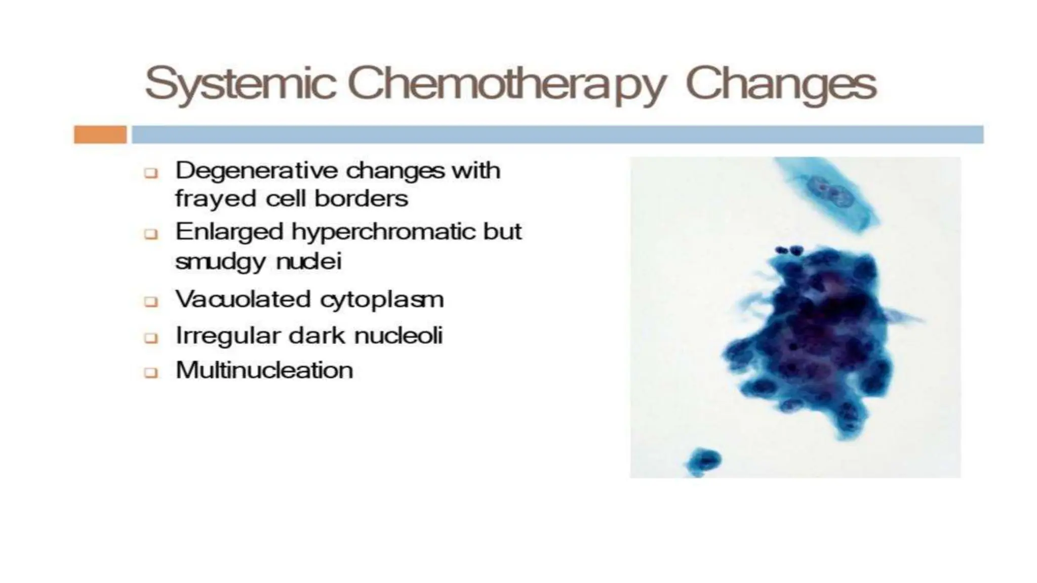 paris system of urine (cytology)Dr.Ankita Singh | PPTX
