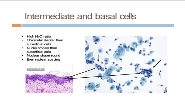 paris system of urine (cytology)Dr.Ankita Singh | PPTX