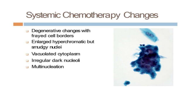 paris system of urine (cytology)Dr.Ankita Singh | PPTX