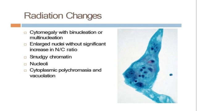 paris system of urine (cytology)Dr.Ankita Singh | PPTX