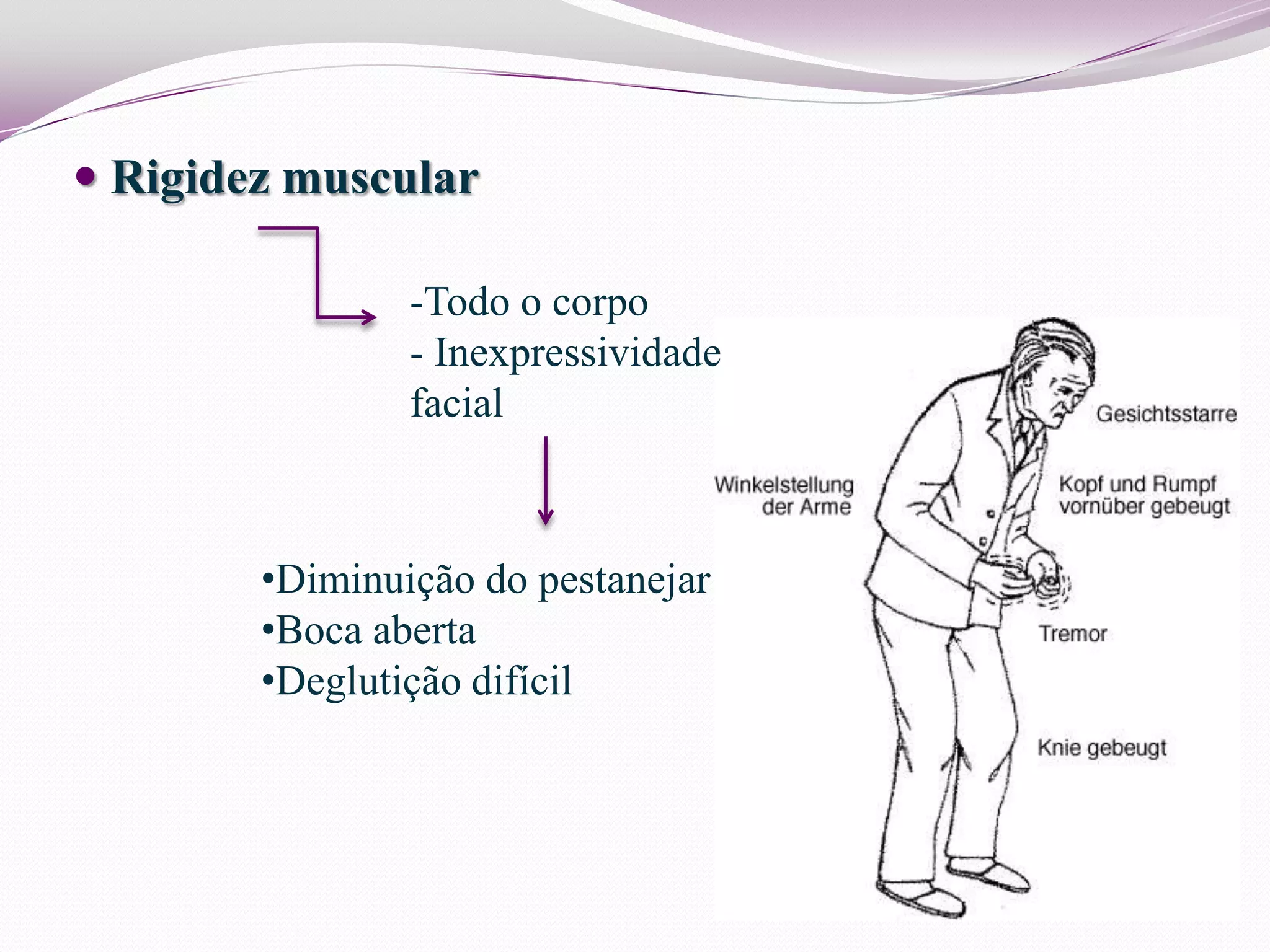 Parkinson | PPTX