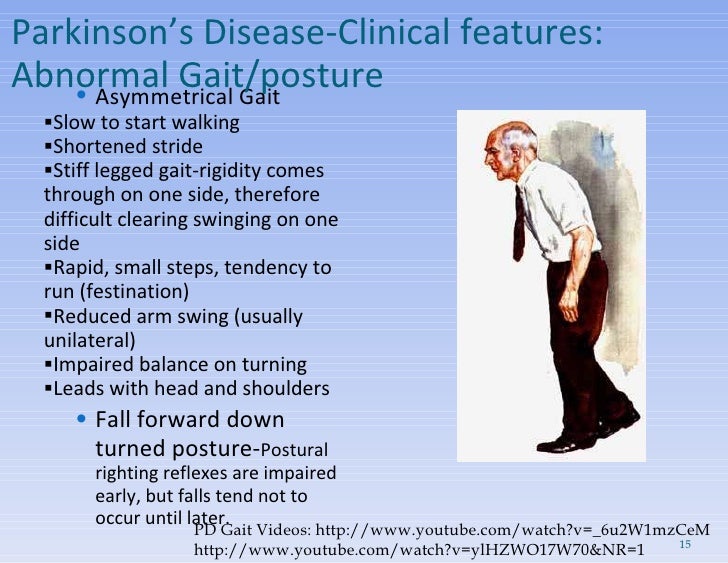 Parkinsons Disease