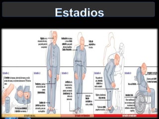 Parkinson(2)[1] | PPTX