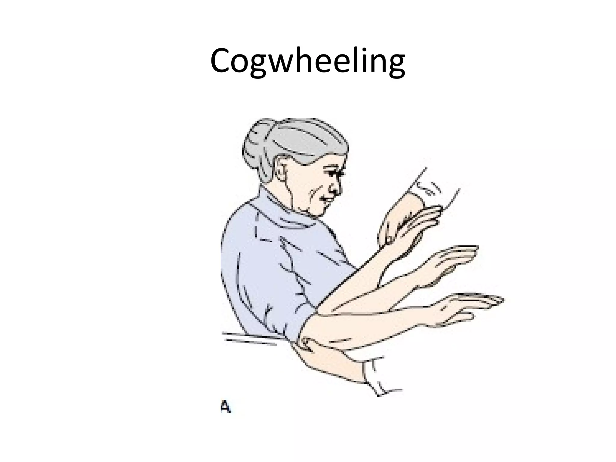 case study on parkinson disease | PPT