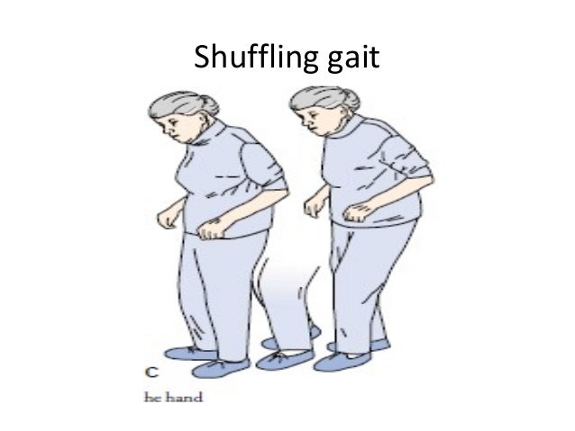 case study on parkinson disease