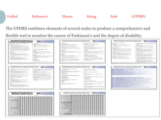 Parkinson's disease | PPT