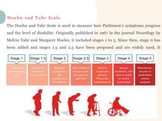 Parkinson's disease | PPTX