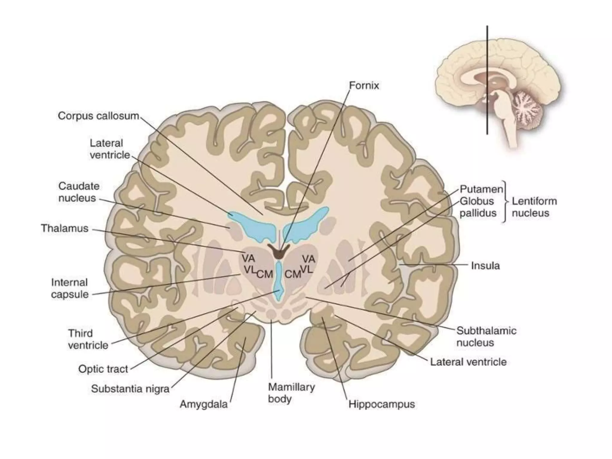 Hypokinetic Movement Disorders - Parkinson disease | PPTX