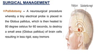 PARKINSON'S DISEASE Presentation by Rajee | PPTX