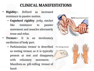 Parkinson disease Clinical Manifestations and Treatment | PPTX