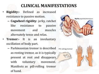 Parkinson diseases | PPTX
