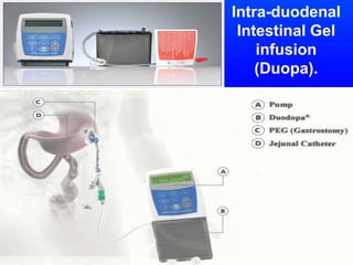 Management of advanced Parkinson's Disease. dr. Walid Reda Ashour, MD | PPT