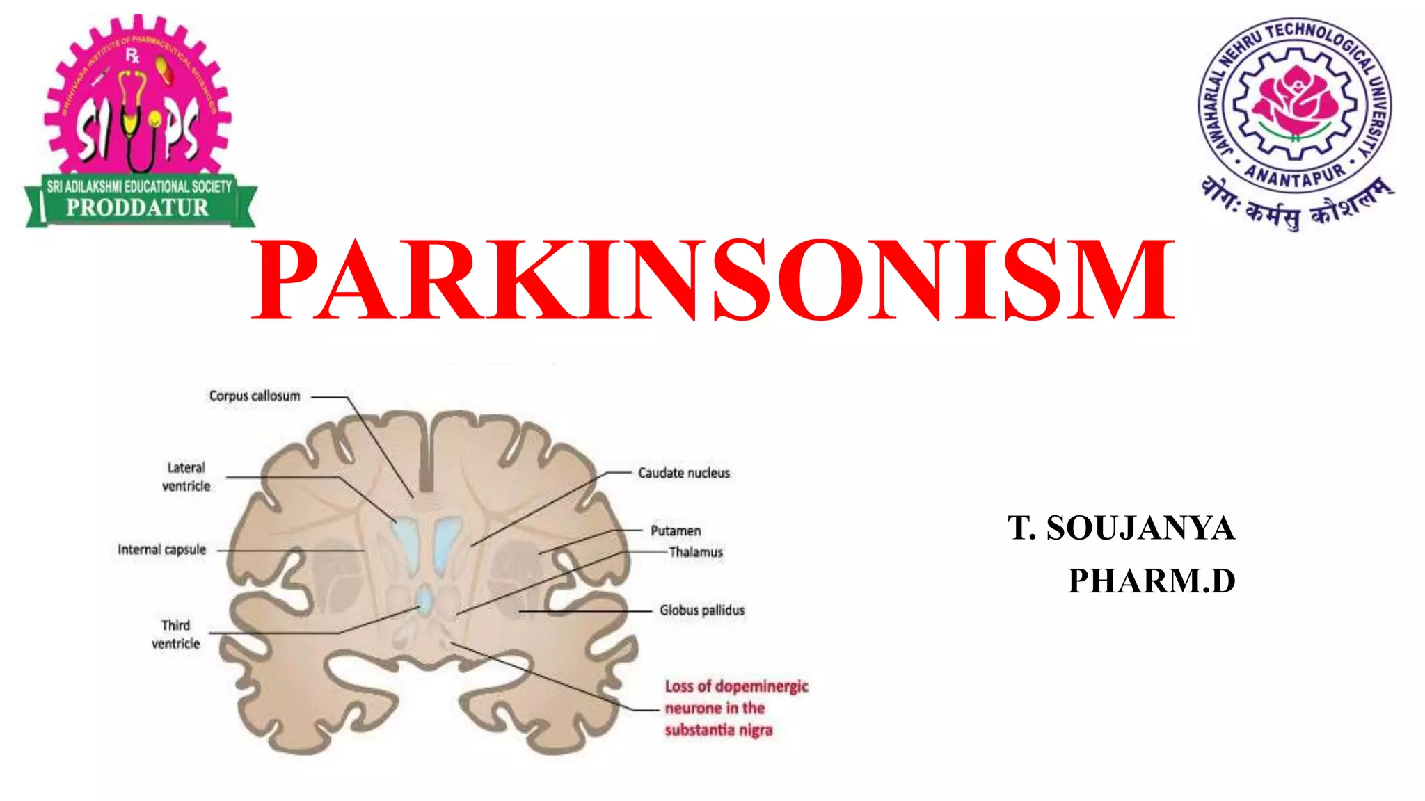 Pathophysiology of Parkinsonism and its management for Pharm.D (Pharmacotherapeutics-III) | PPTX