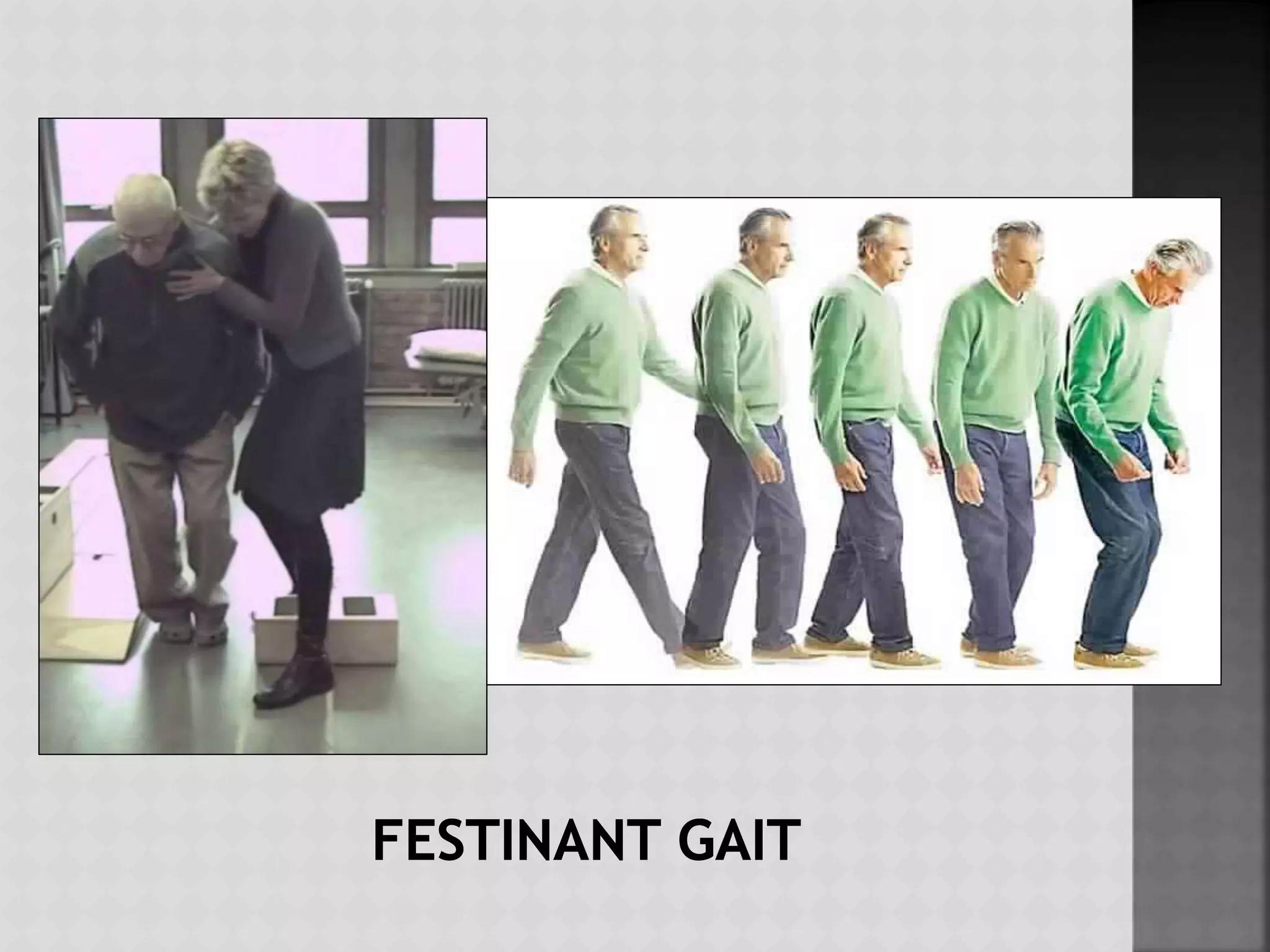 Parkinsonism - An Ayurvedic approach | PPTX