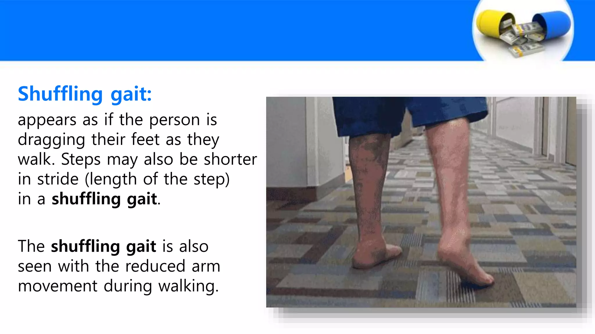 Parkinsonism, Parkinson’s Disease | PPTX