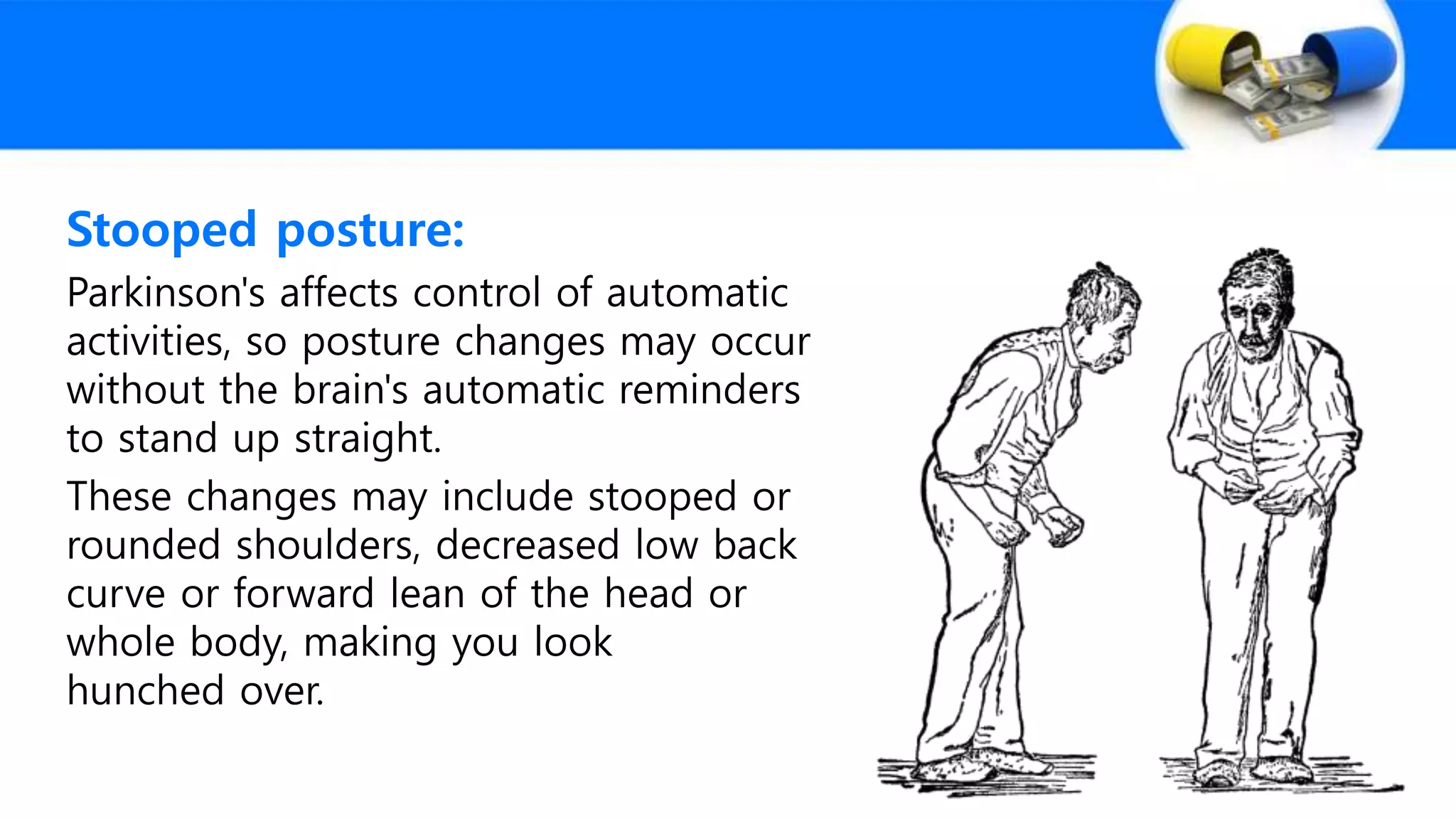 Parkinsonism, Parkinson’s Disease | PPTX