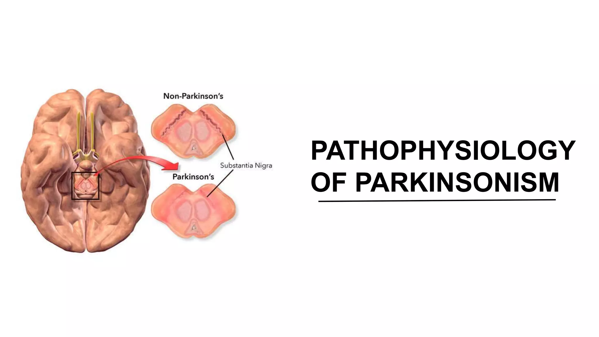 Parkinsonism, Parkinson’s Disease | PPTX