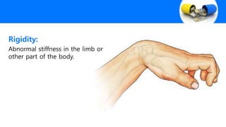 Parkinsonism, Parkinson’s Disease | PPTX