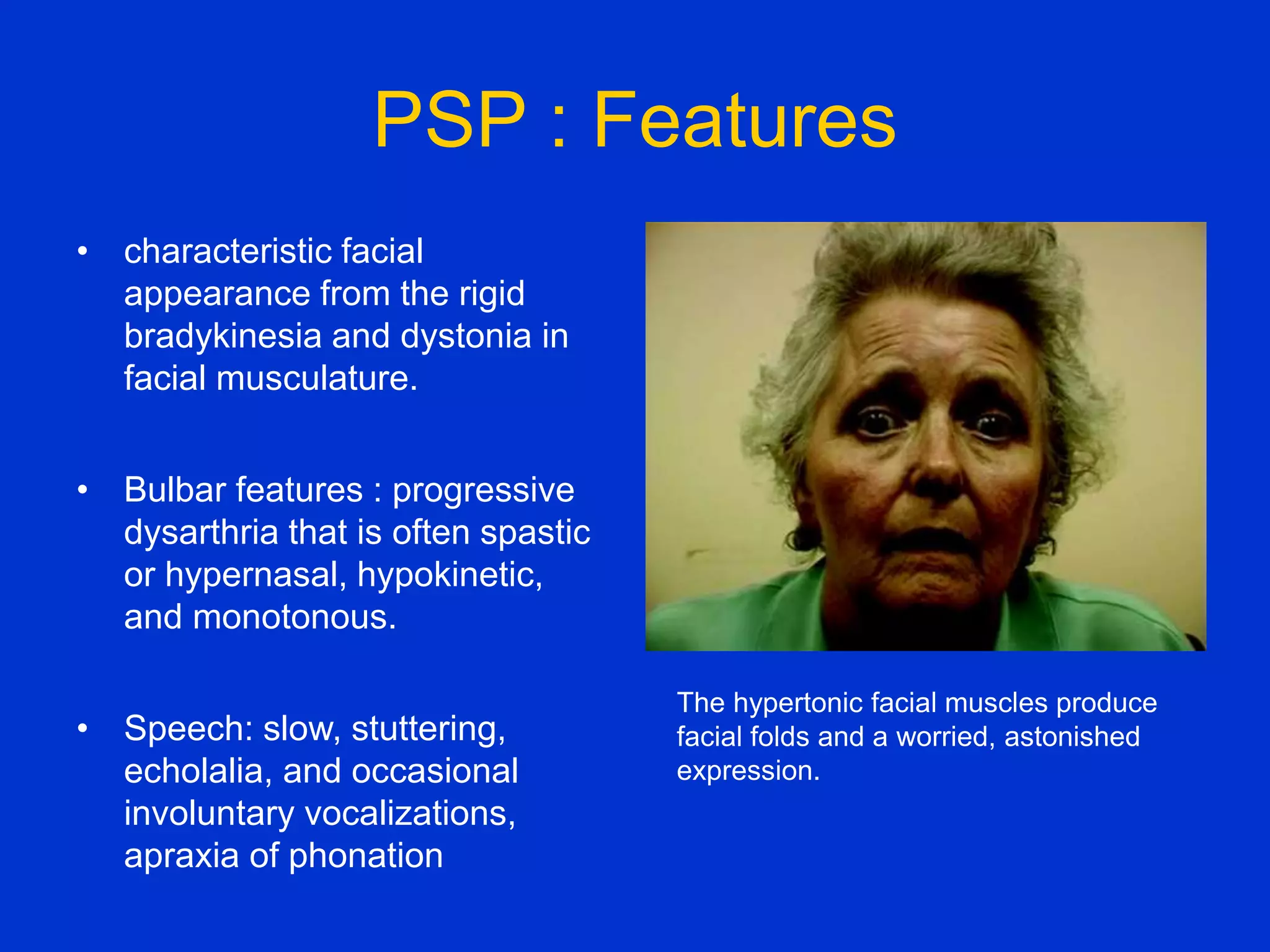 Parkinson plus syndrome | PPT