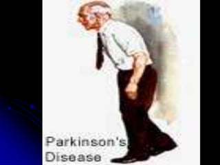 Η νοσος του Parkinson (Πυρρής Ν.) | PPT