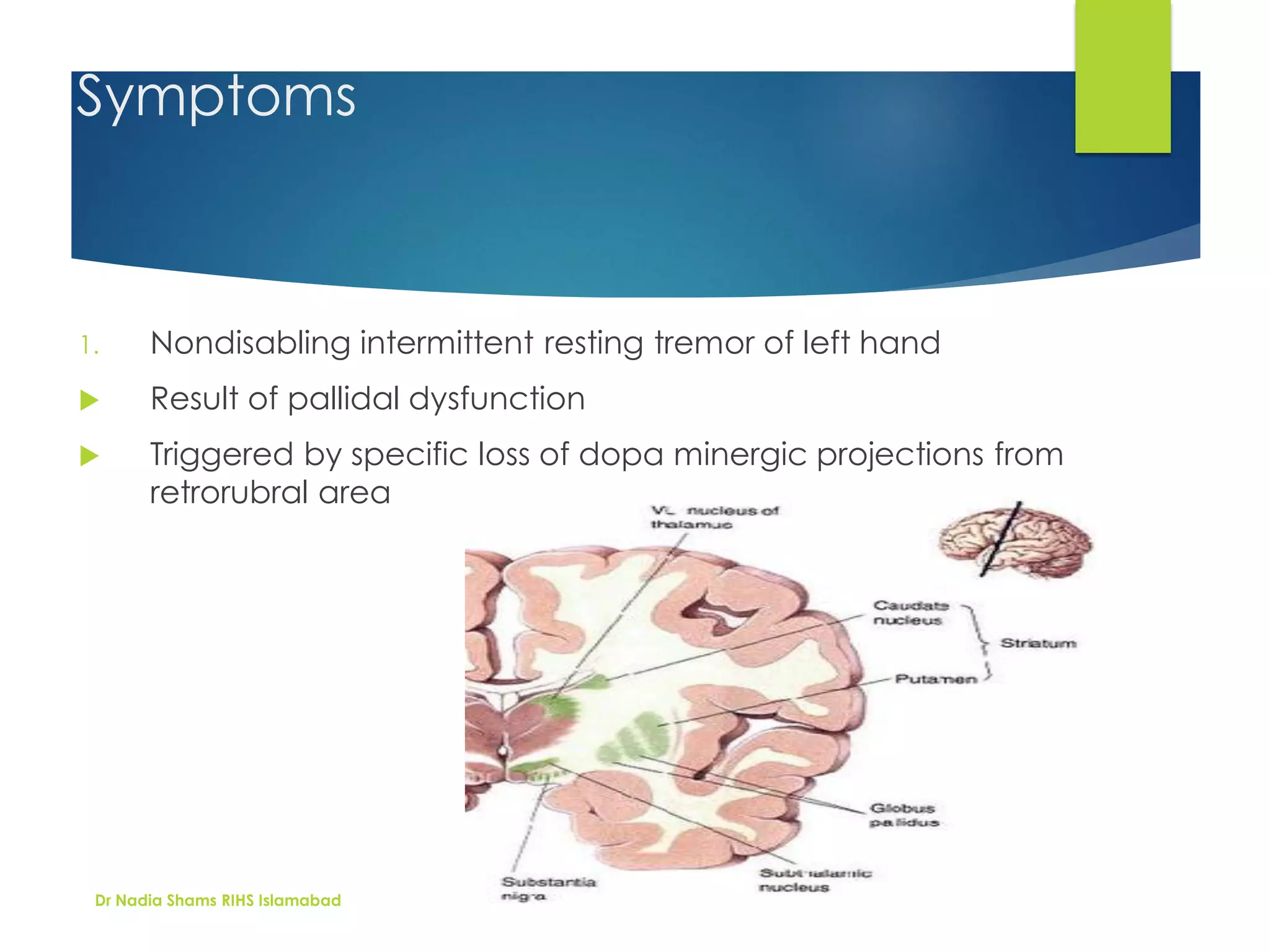 Parkinson's Disease - Neurology | PDF
