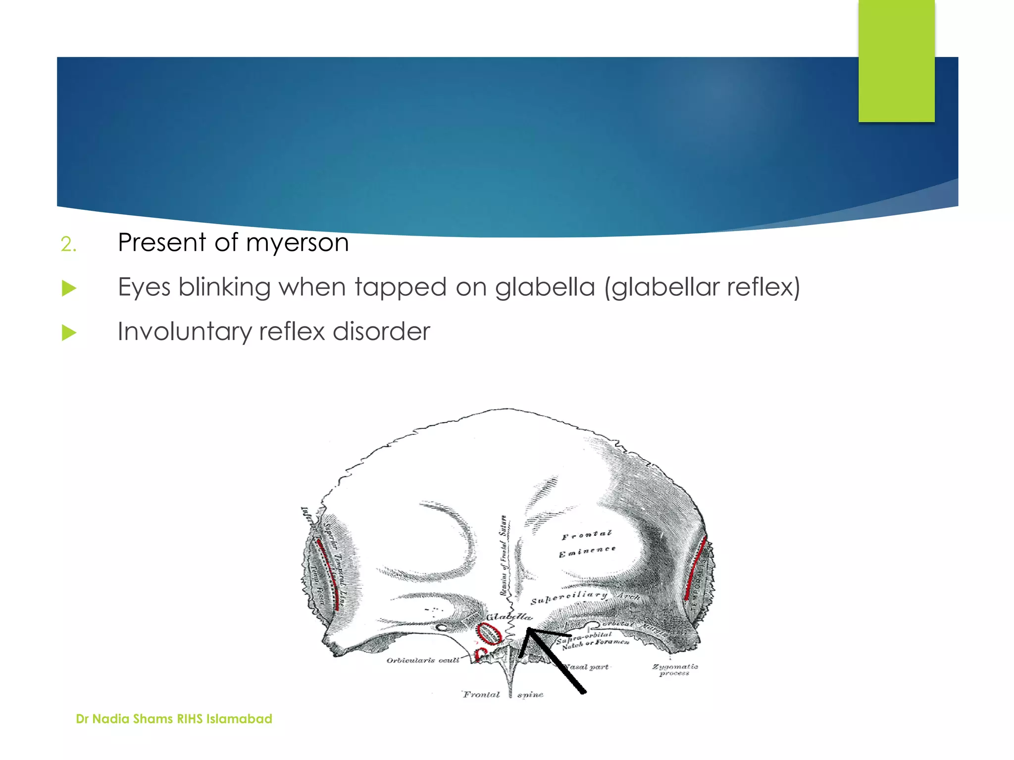 Parkinson's Disease - Neurology | PDF