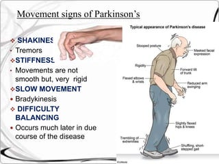 Parkinson's manasi india 17 | PPTX