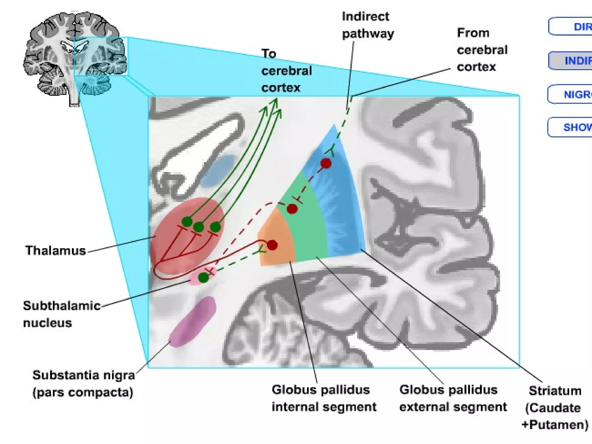 Parkinsons disease and physiotherapy | PPT