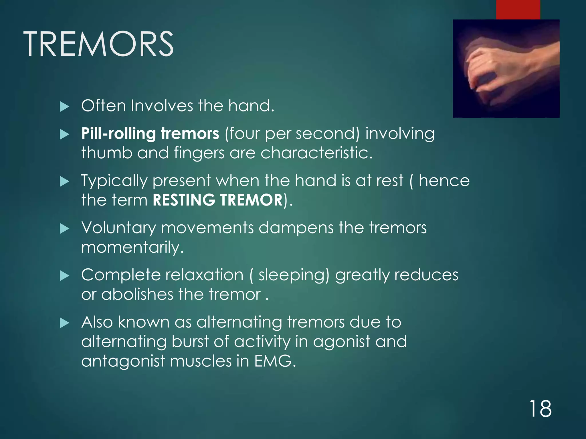 Parkinson’s disease | PPTX