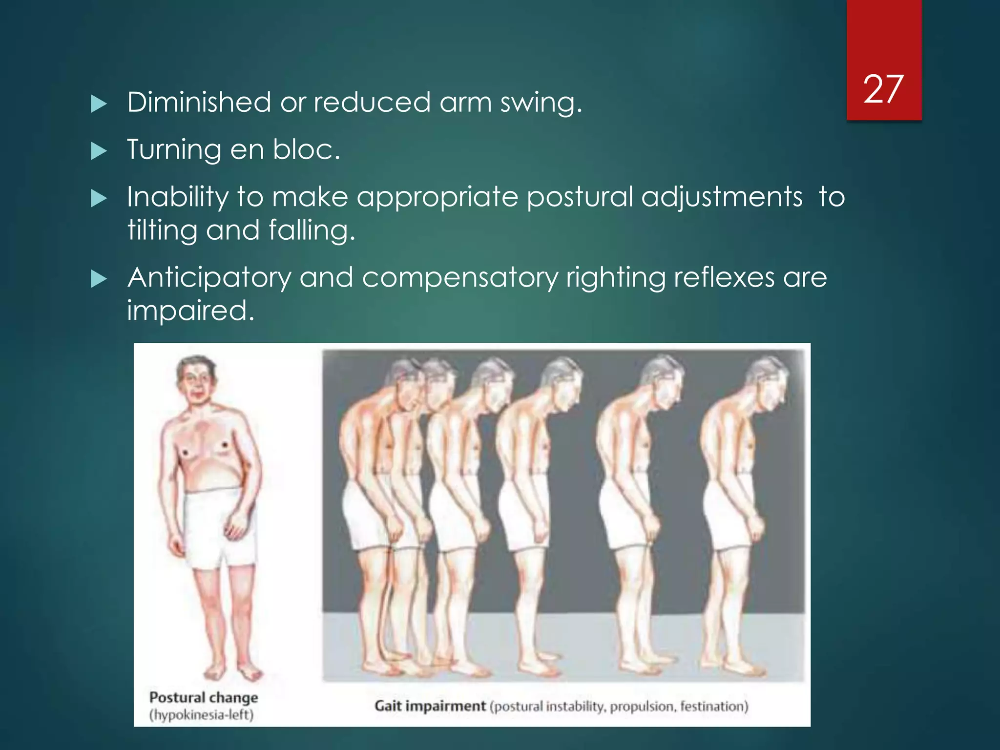 Parkinson’s disease | PPTX