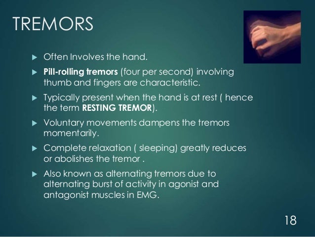 Parkinson’s disease