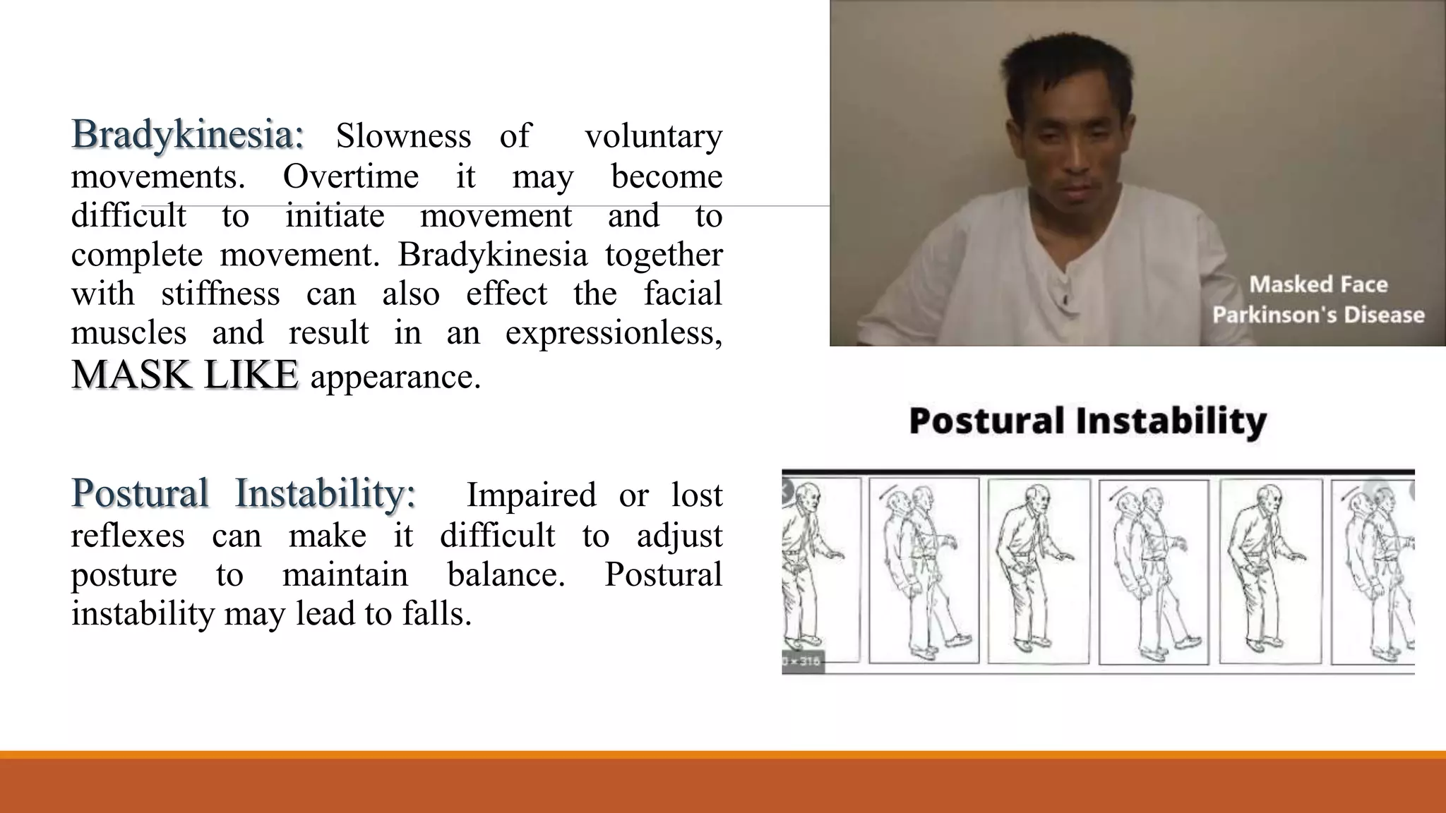 Parkinson's disease | PPTX