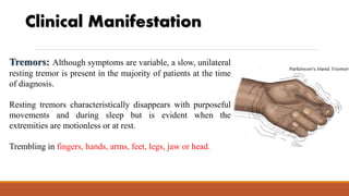 Parkinson's disease | PPTX | Brain and Nervous System Disorders ...