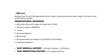 parkinsons disease.pptx