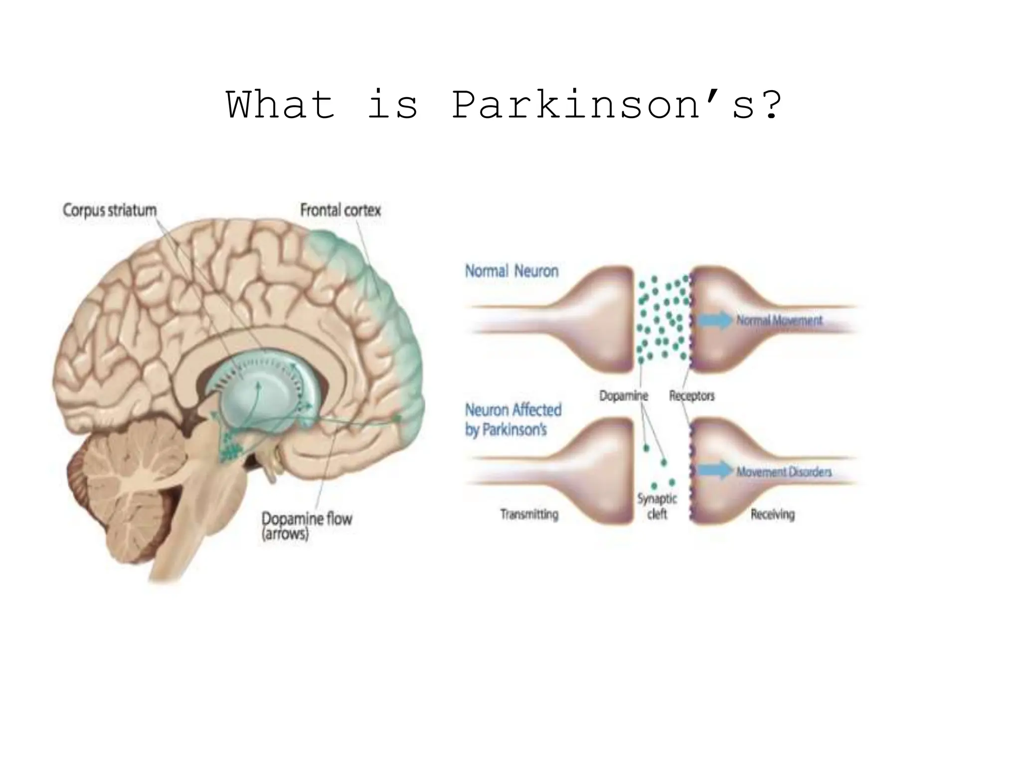 Pathophysiology of Parkinson’s Disease Neurodegenerative disorders | PPT