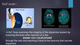 PARKINSON’S DISEASE.ppt . | PPT