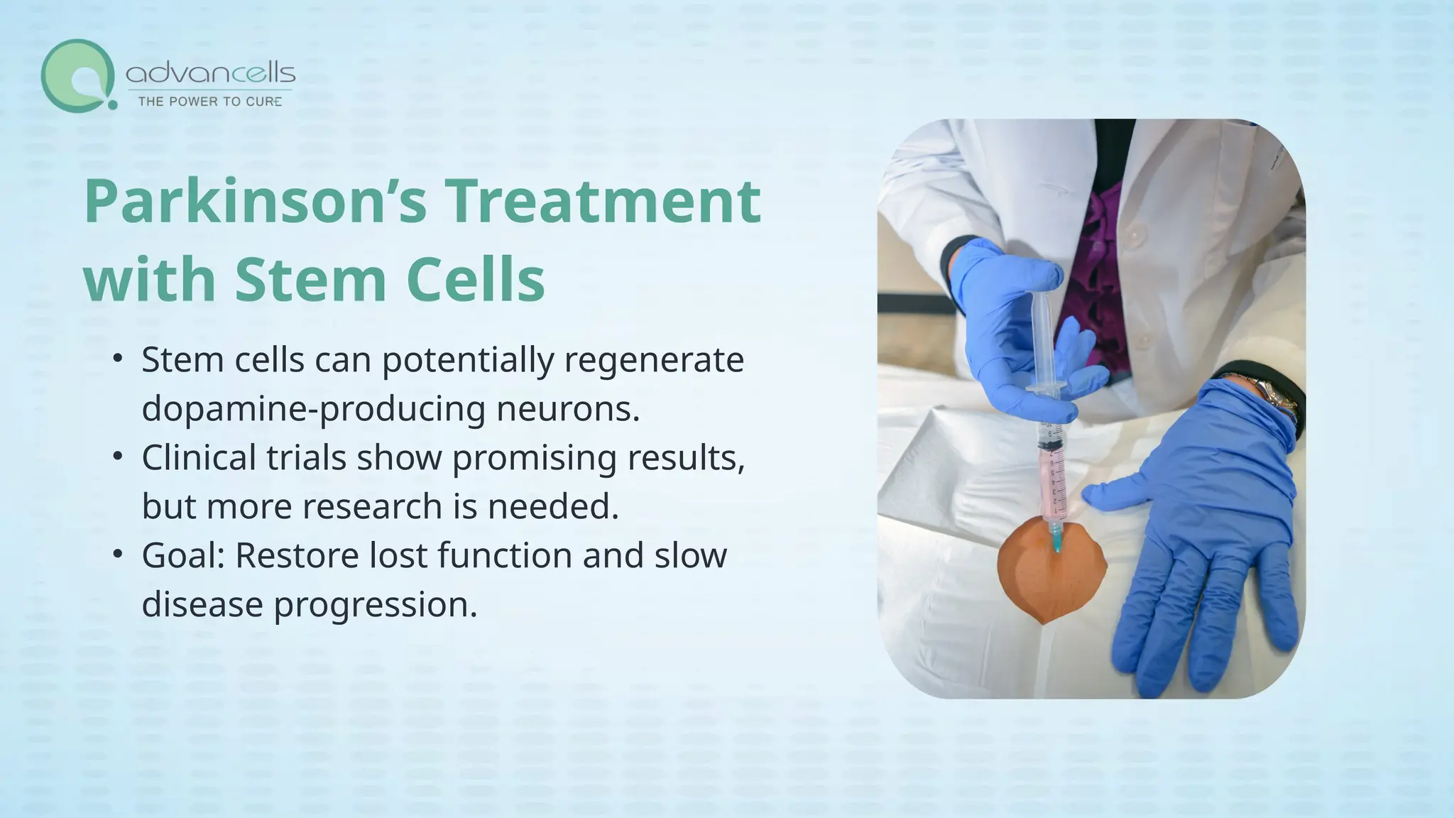 Parkinson’s Disease: Diagnosis, Symptoms, and Treatment with Stem Cells ...