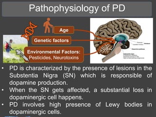Parkinson's Disease (PD) | PDF