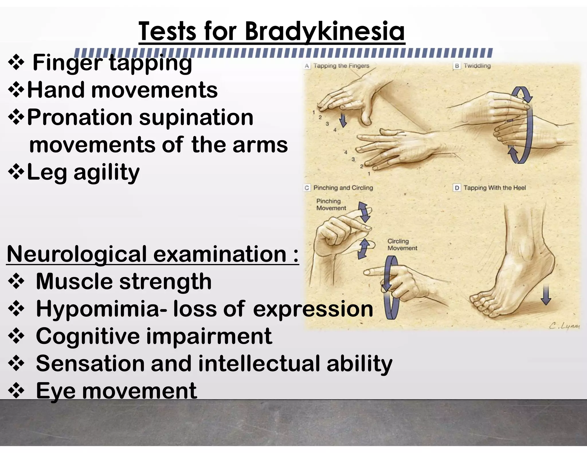 PARKINSON'S DISEASE PPT PDF.pdf
