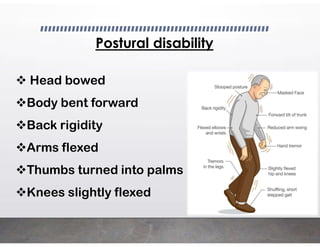 PARKINSON'S DISEASE PPT PDF.pdf