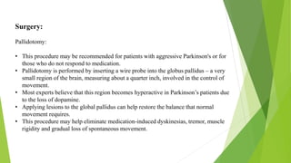 Parkinson's disease treatment | PPTX