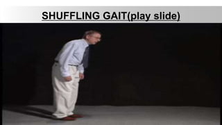 parkinson's disease (updated).pptx